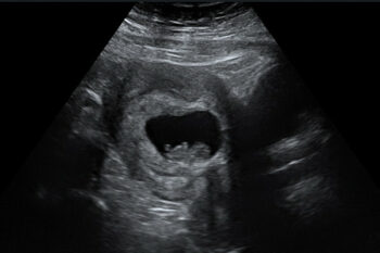 Baby Scanning Services - Scanning Services - Hello Baby