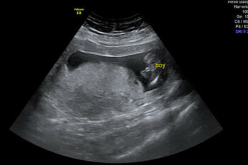 Baby Scanning Services - Scanning Services - Hello Baby