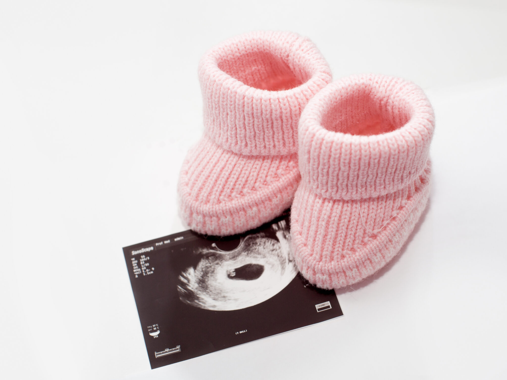 Gender Scans - Early Gender Scans St Helens - Hello Baby